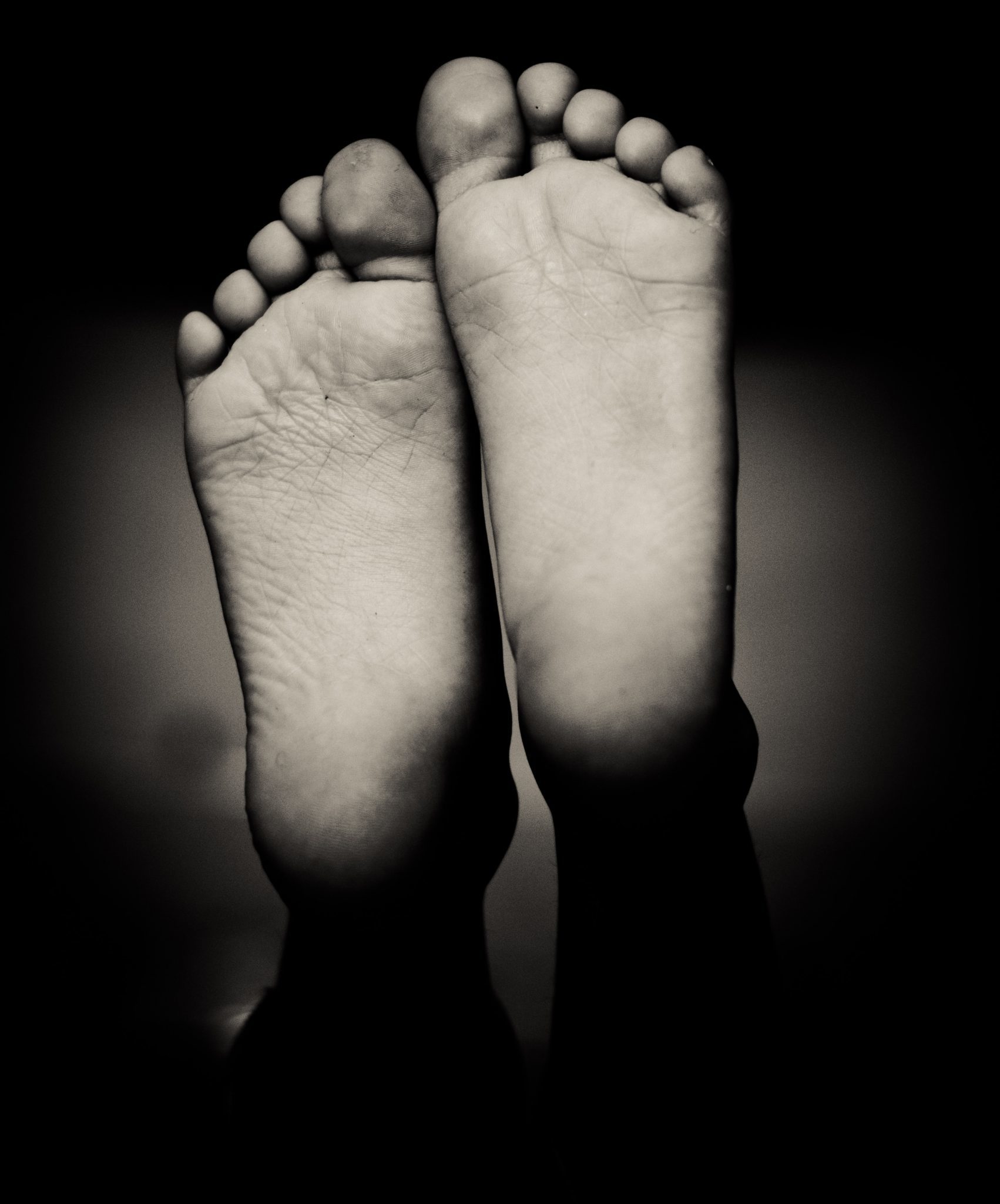 Charcot Neuroarthropathy: It’s tricky. - The Mayer Institute